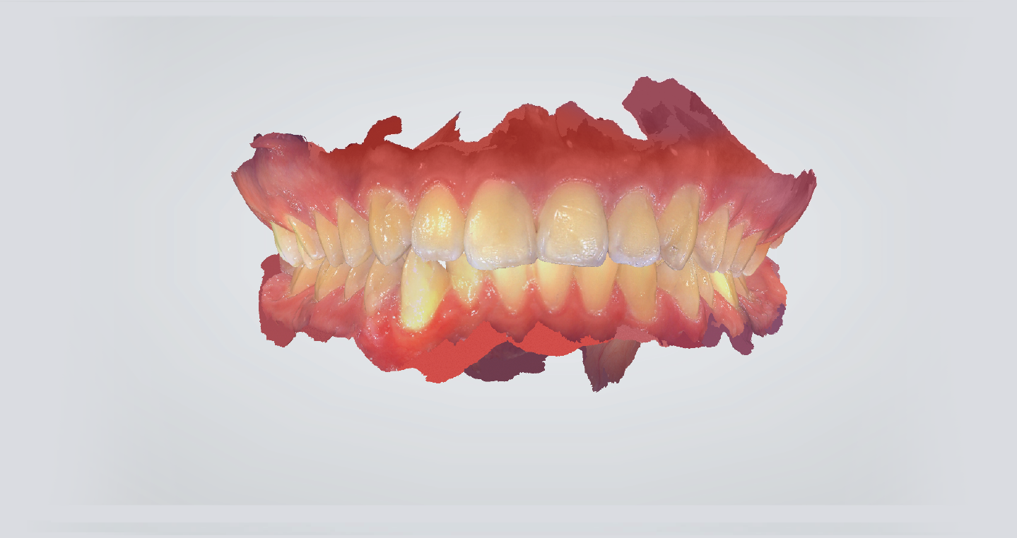 Galeria – Panda Scanner